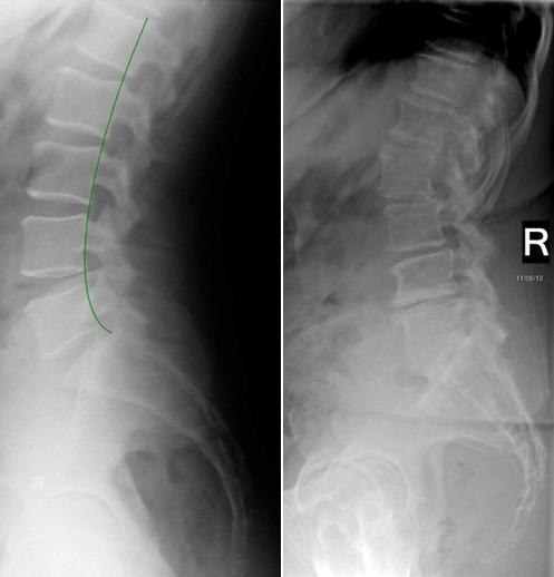 Back Pain | Spine, Body & Health